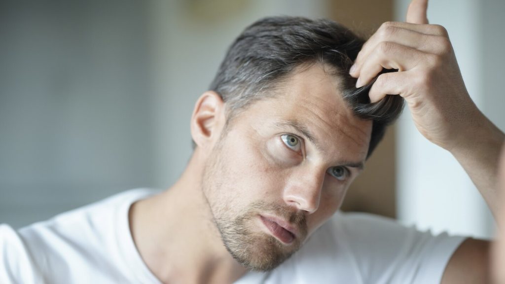 Men’s Guide To A Healthy Scalp: Essential Tips And Tricks - Body Health ...